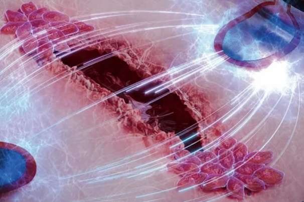 Cientistas encontram maneira de curar feridas 3 vezes mais rápido ...